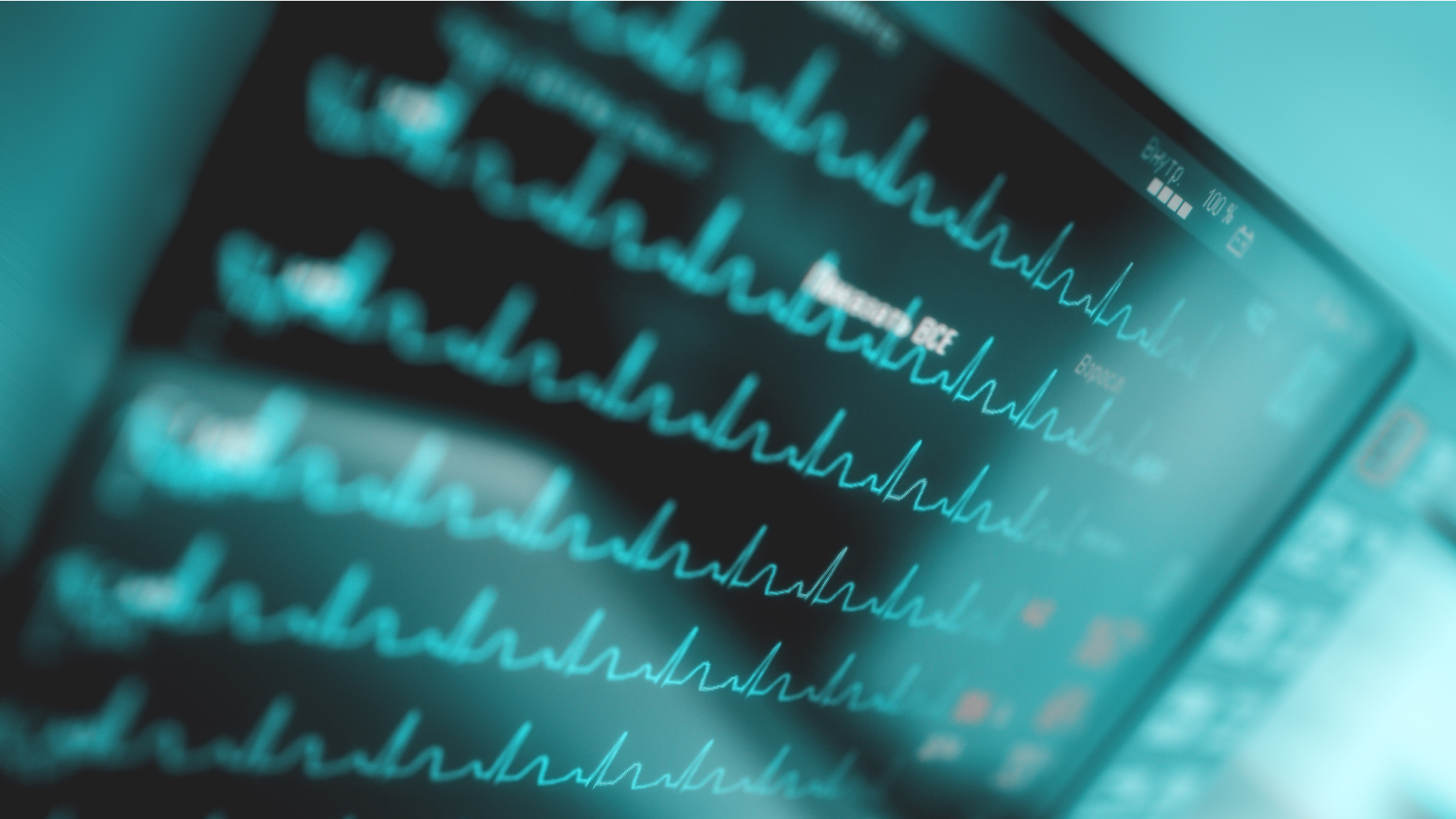 VitalConnect’s Cardiac Monitoring “VitalPatch” Receives Emergency FDA ...